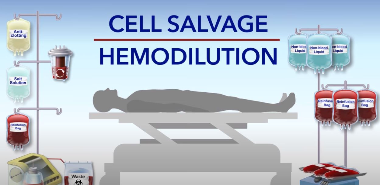 Cell Salvage Machines For Bloodless Surgery - My Medical Choice Blog